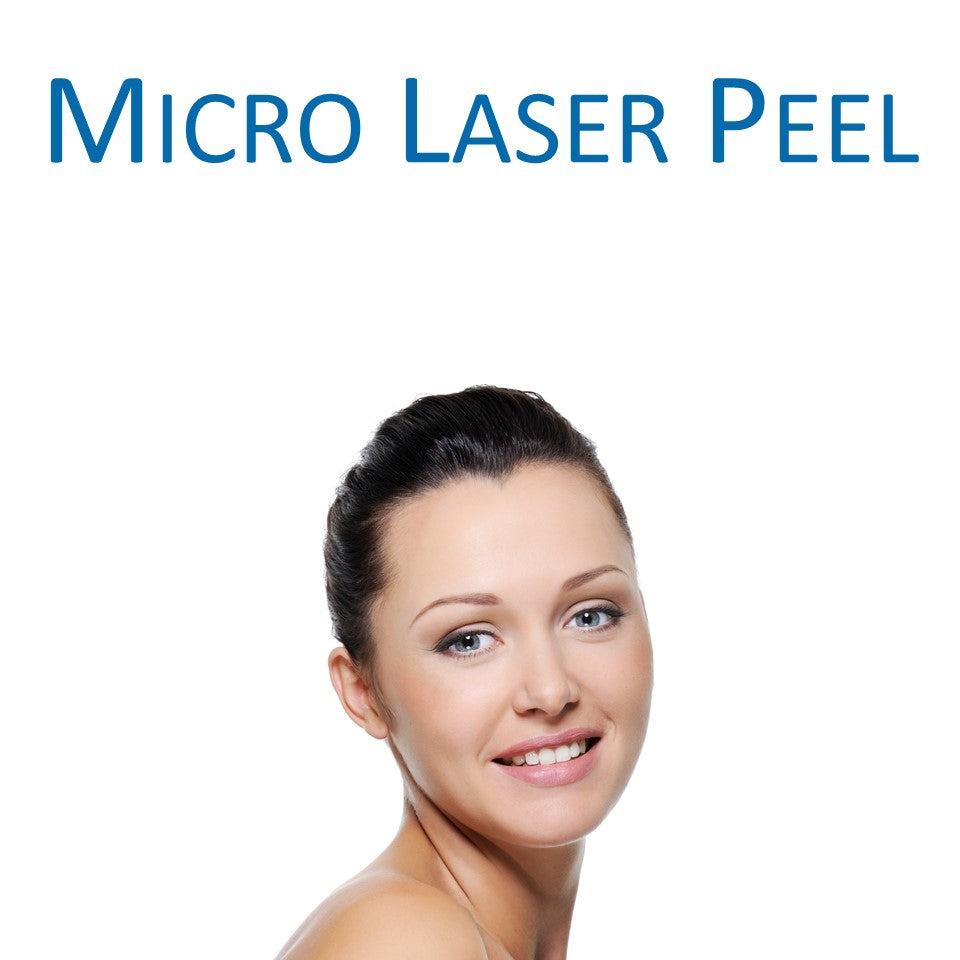 Micro Laser Peel – A E Skin